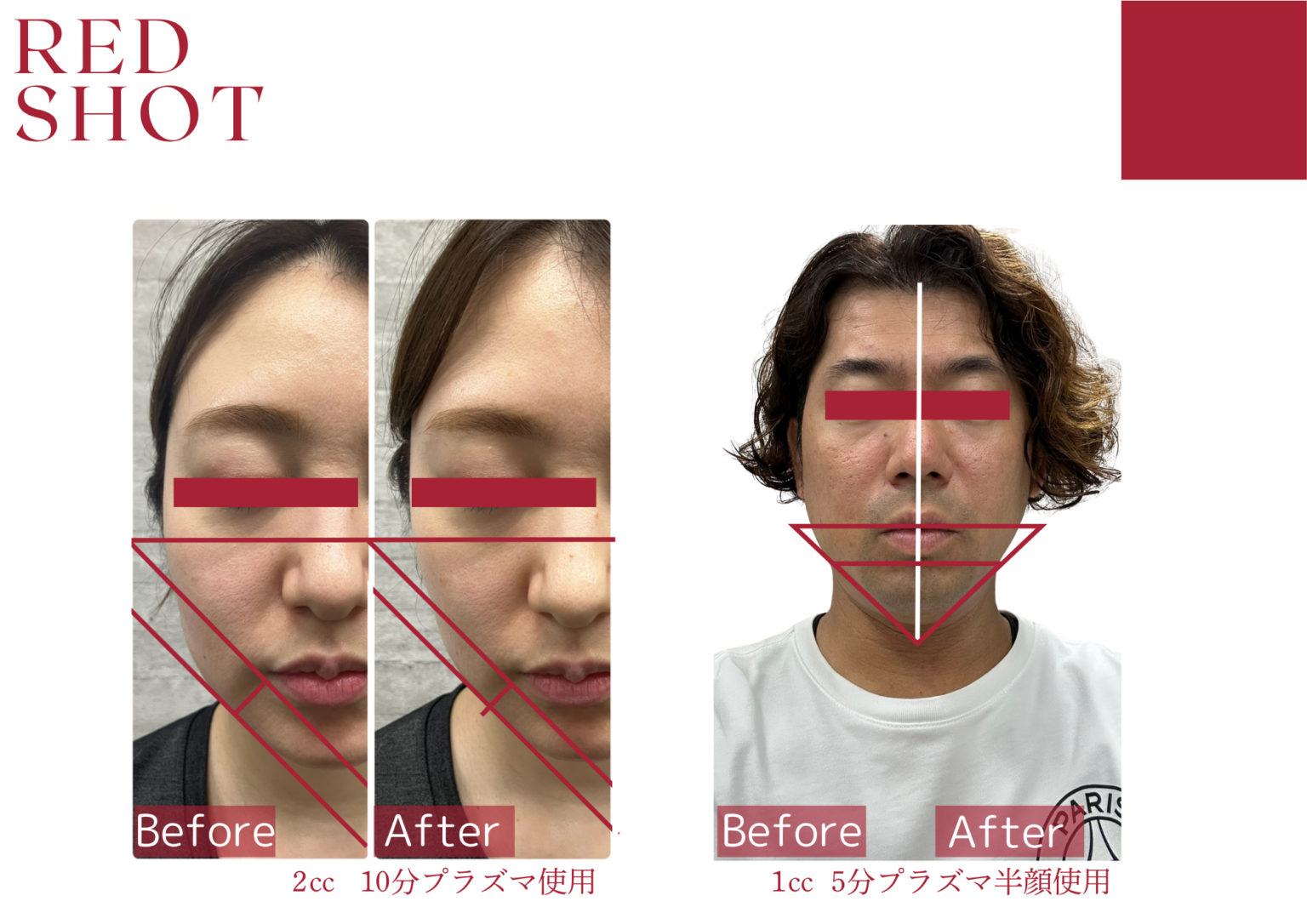 RED SHOT レッドショット | 美容メーカー|トライアングルアンドコー